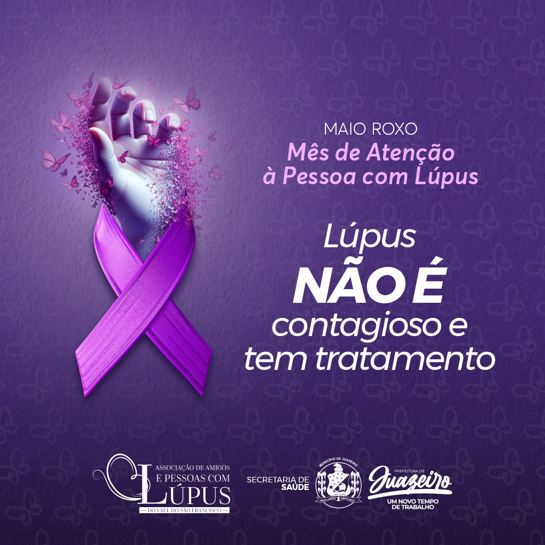 Maio Roxo: Prefeitura de Juazeiro conscientiza sobre Lúpus e divulga ...